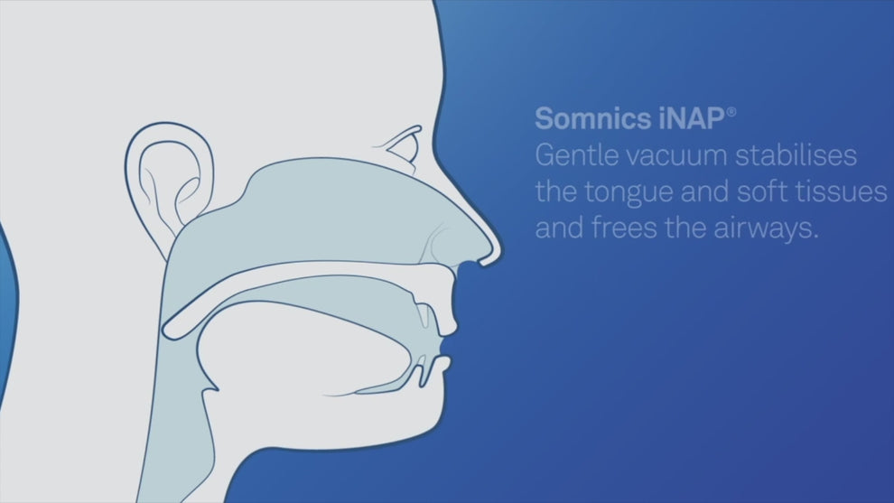 iNAP One Sleep Therapy Premium – Somnics Health